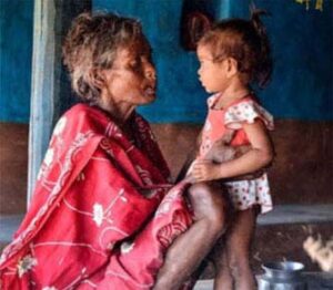 Stories Of Change - Health - Smile Foundation